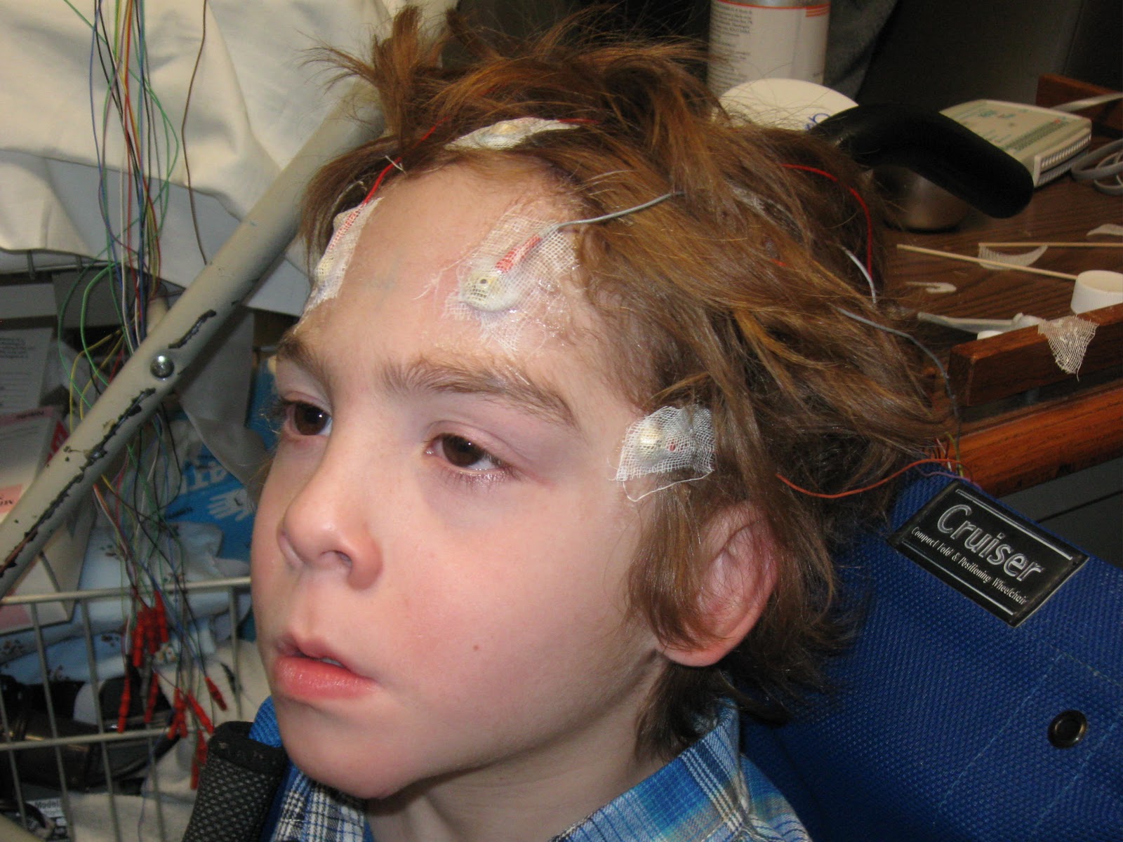 The Real Deal: Video EEG