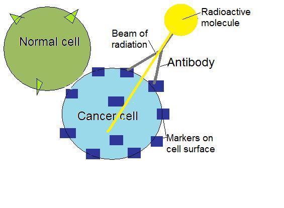 Radioimmunotherapy: A HOT new cancer treatment: An Overview of ...