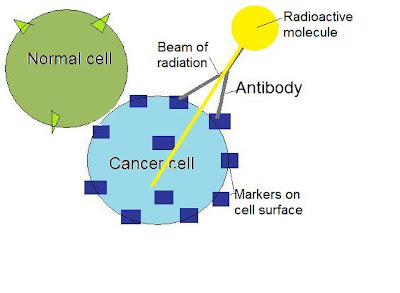 Radioimmunotherapy: A HOT new cancer treatment: An Overview of ...