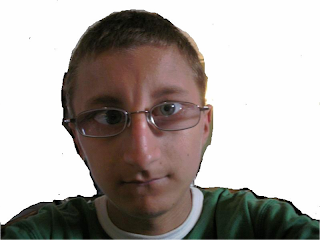 TECNOLOGIAS Y RECURSOS: SINDROME FLOATING HARBOR