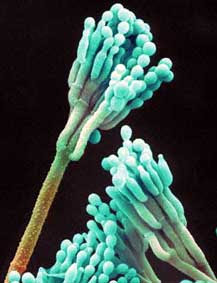 Reino Fungi: Classificação dos fungos