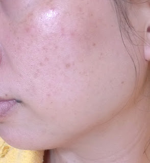 我的 Refoderm Tonic Water 體驗