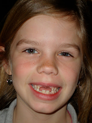 The Footes: Snaggletooth!!