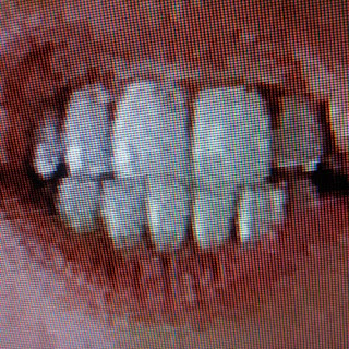 Celebrity Smile Watch: Amanda Peet bulky teeth