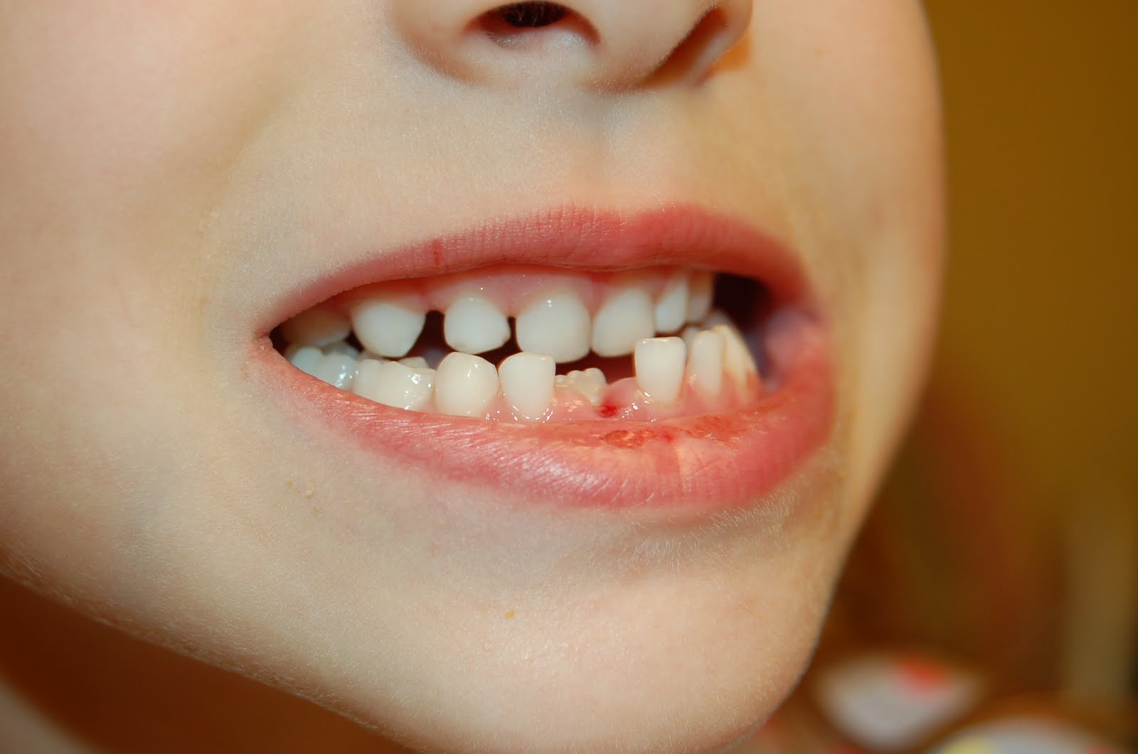 My Double Life: My family's first lost tooth!