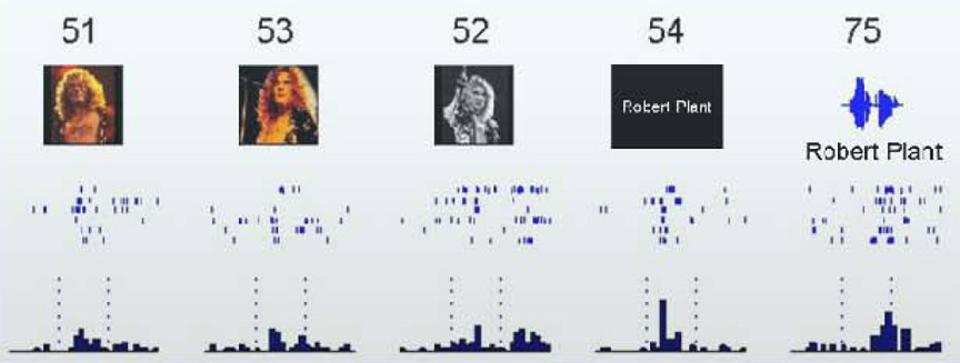 milozjam: Minus Et Cortex