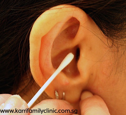 Karri Family Clinic Tampines: Ear Wax and Cotton Buds
