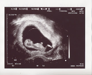 the beginning of pregnancy #2: 10 weeks, 6 days