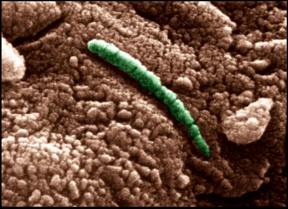 Meteorito ALH84001 muestra evidencia de vida microscópica en Marte ...