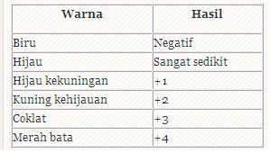 analis laboratorium kesehatan: Membaca hasil lab urin