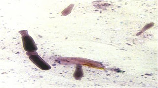 La Vitácora del Dr. Mathews: La Gregarina