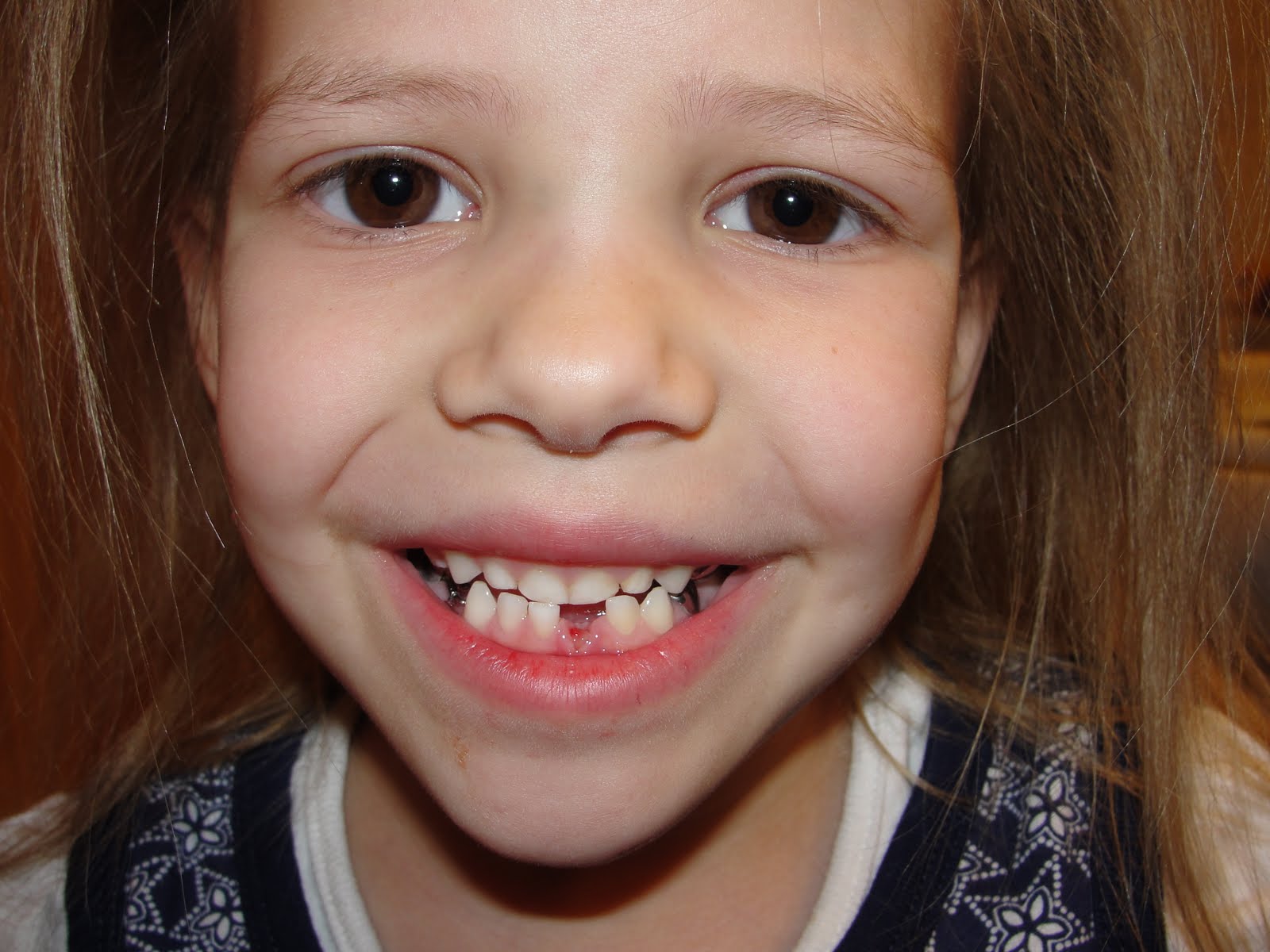 You Asked For It...: all* the missing photos