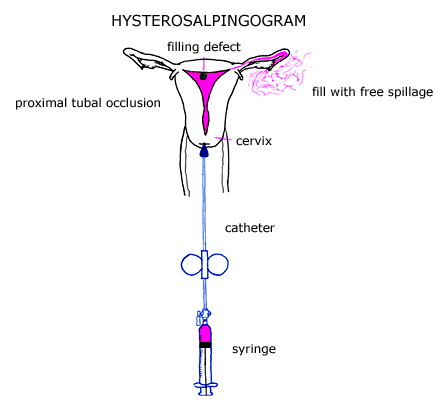what's in for today - TTC ing for the first: Yet another unsuccesful ...