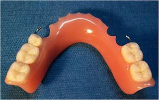 SALUD ORAL SAB. DRA. CLAUDIA ZULUAGA: PROTESIS DENTAL