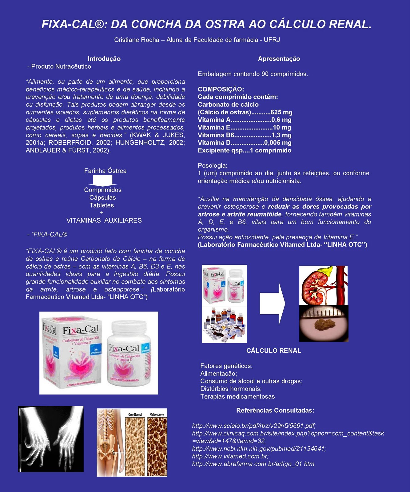 Bromatologia em Saúde: FIXA-CAL®: DA CONCHA DA OSTRA AO CÁLCULO RENAL.