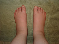 Boring Blog-O-Beth: Cankles