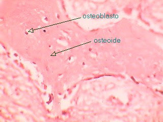 Laboratorios: TEJIDO OSEO