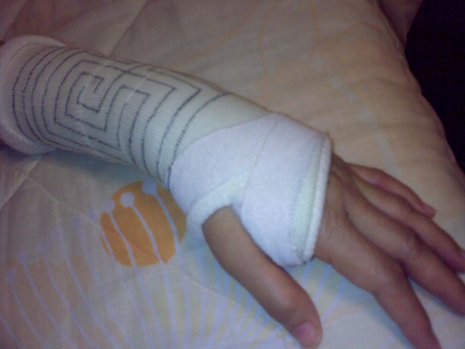 How To Wash Someone With A Broken Arm at Daniel Shears blog