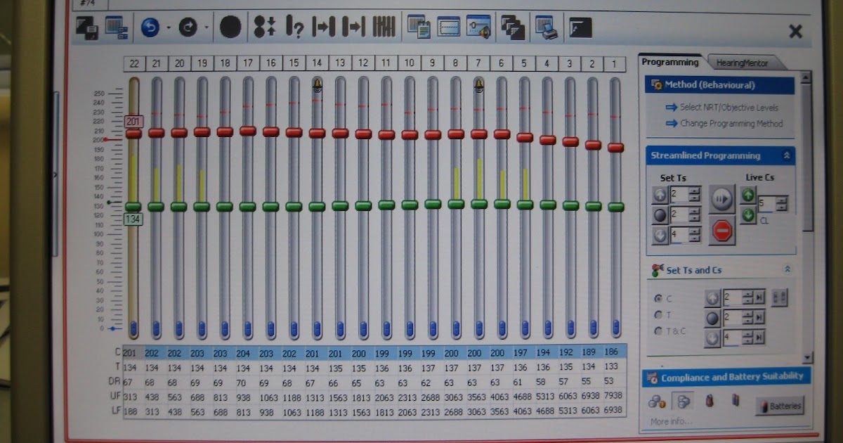 Bionic Wombat - Bilateral cochlear recipient: Right mapping update