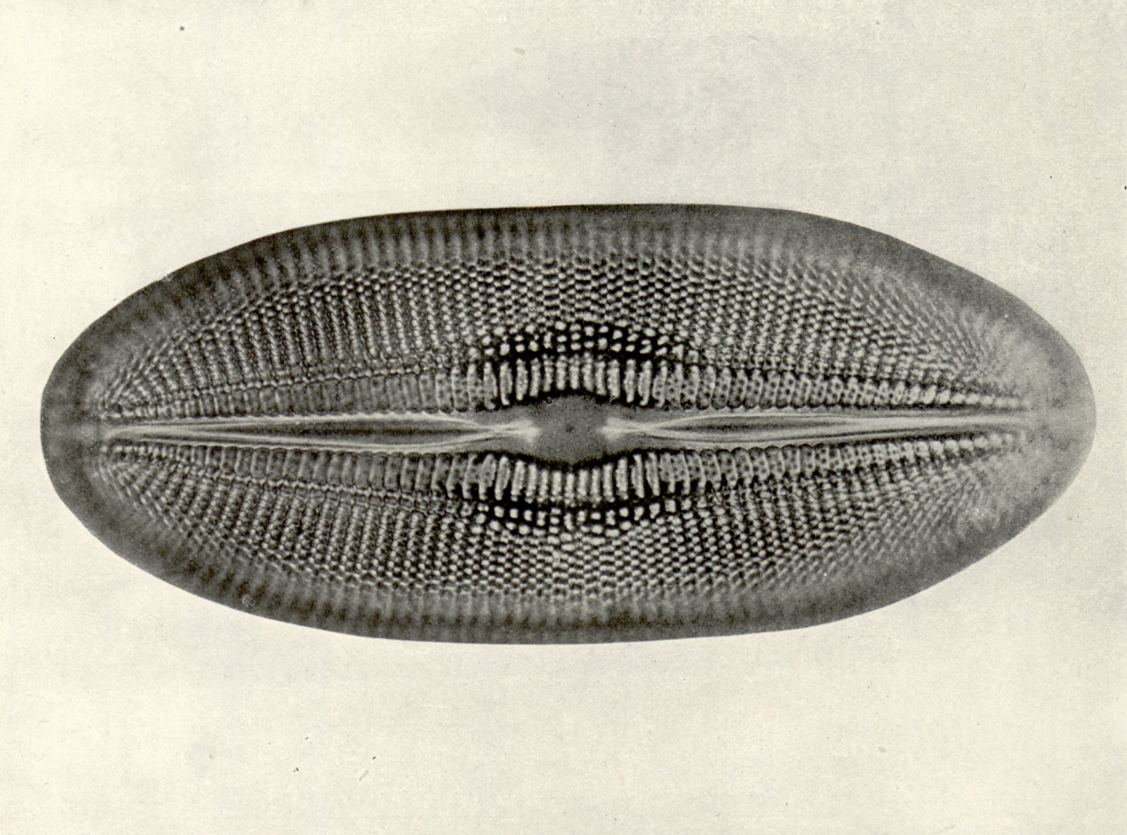Não me mexam nos JPEGS!: ONTOS - Uma diatomácea em 1911