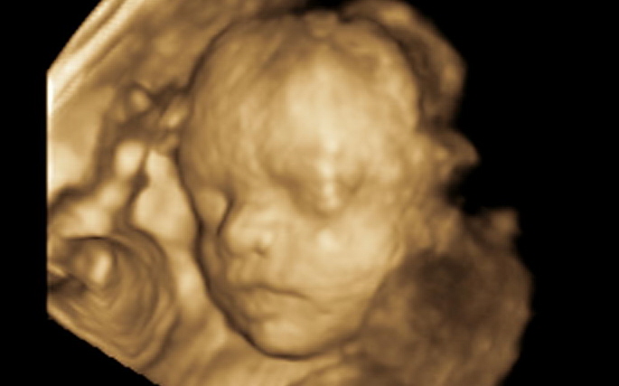 Jennys blogg: 3D/4D ultraljud??