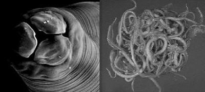 5 Most Gruesome Pictures of Horrific Parasitic Worms ~ Somethin Bizarre
