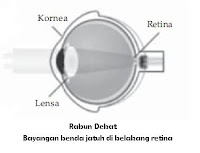 ITC OPTIK MANGGA DUA: Info Optik