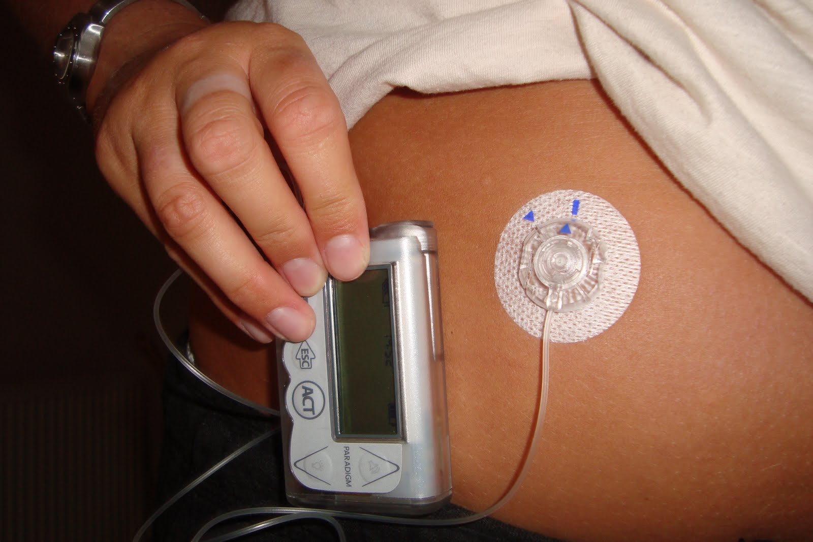 Insulin's Involved: Pump Practice!!!!