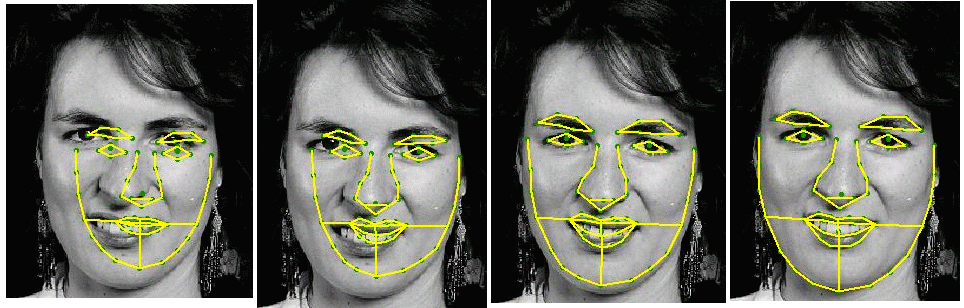 Orthodontic Corner: Automated Digital Tracing of Lateral Cephalograms ...