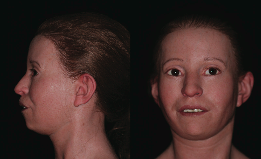 Orthodontic Corner: Facial Reconstruction of an 11 year old female ...