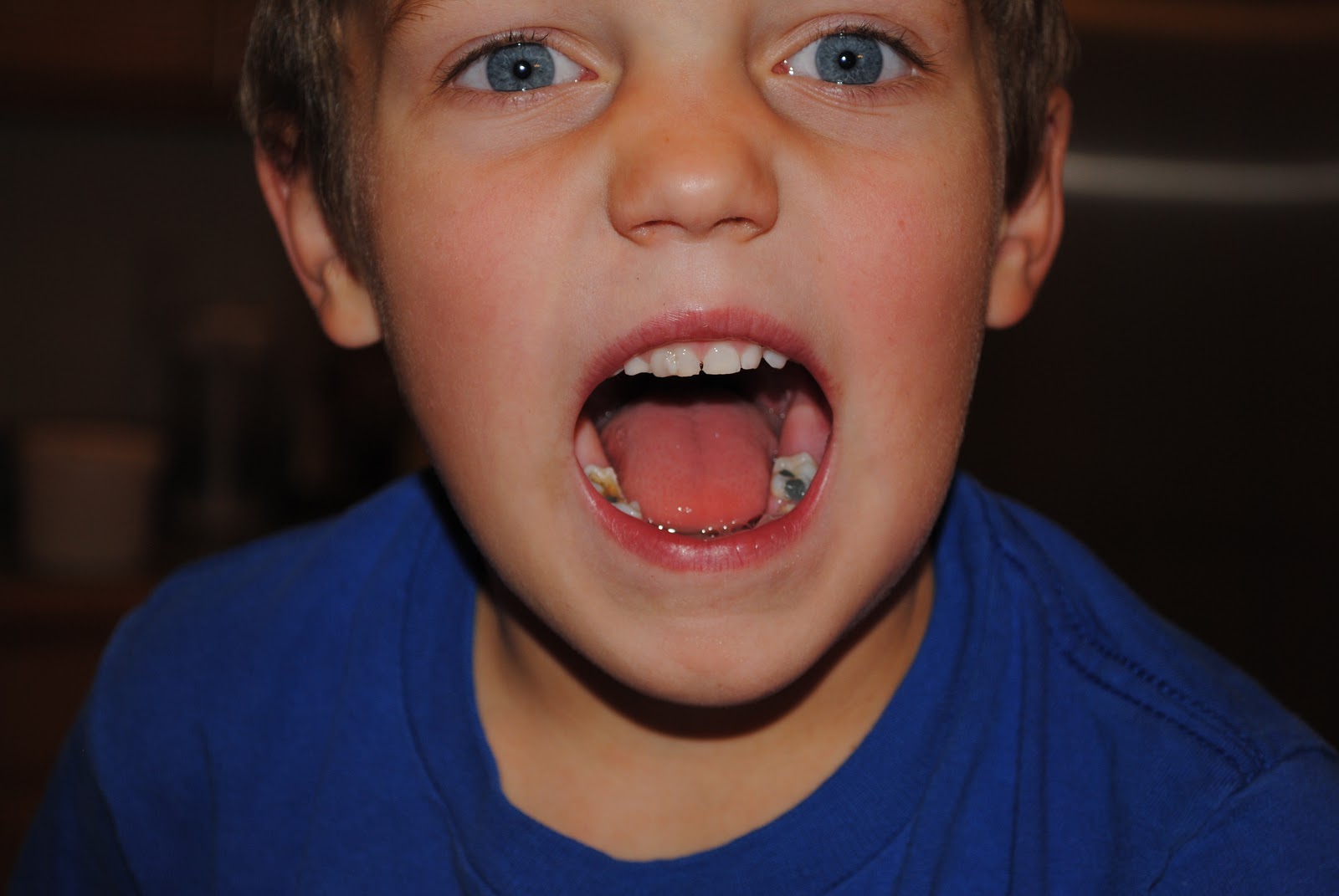 BROWN Team: Tooth & Nail