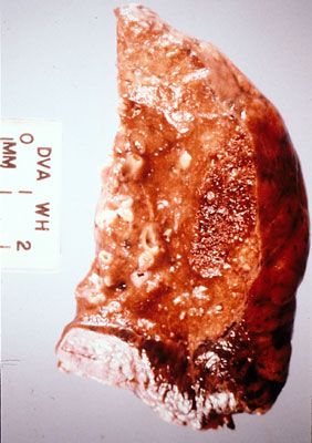 Review of Forensic Medicine: AIIMS MD Entrance Exam November 2010