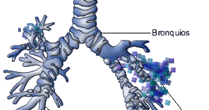 Bronquios, NOMBRE: Noemy Karla Fernández Patón GRUPO 1 - Coggle Diagram