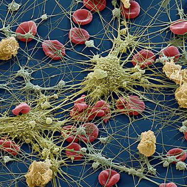 SEXTO GRADO: IMÁGENES DE CÉLULAS VISTA DESDE UN MICROSCOPIO
