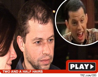 Balding Celebrities!!: Jon Cryer