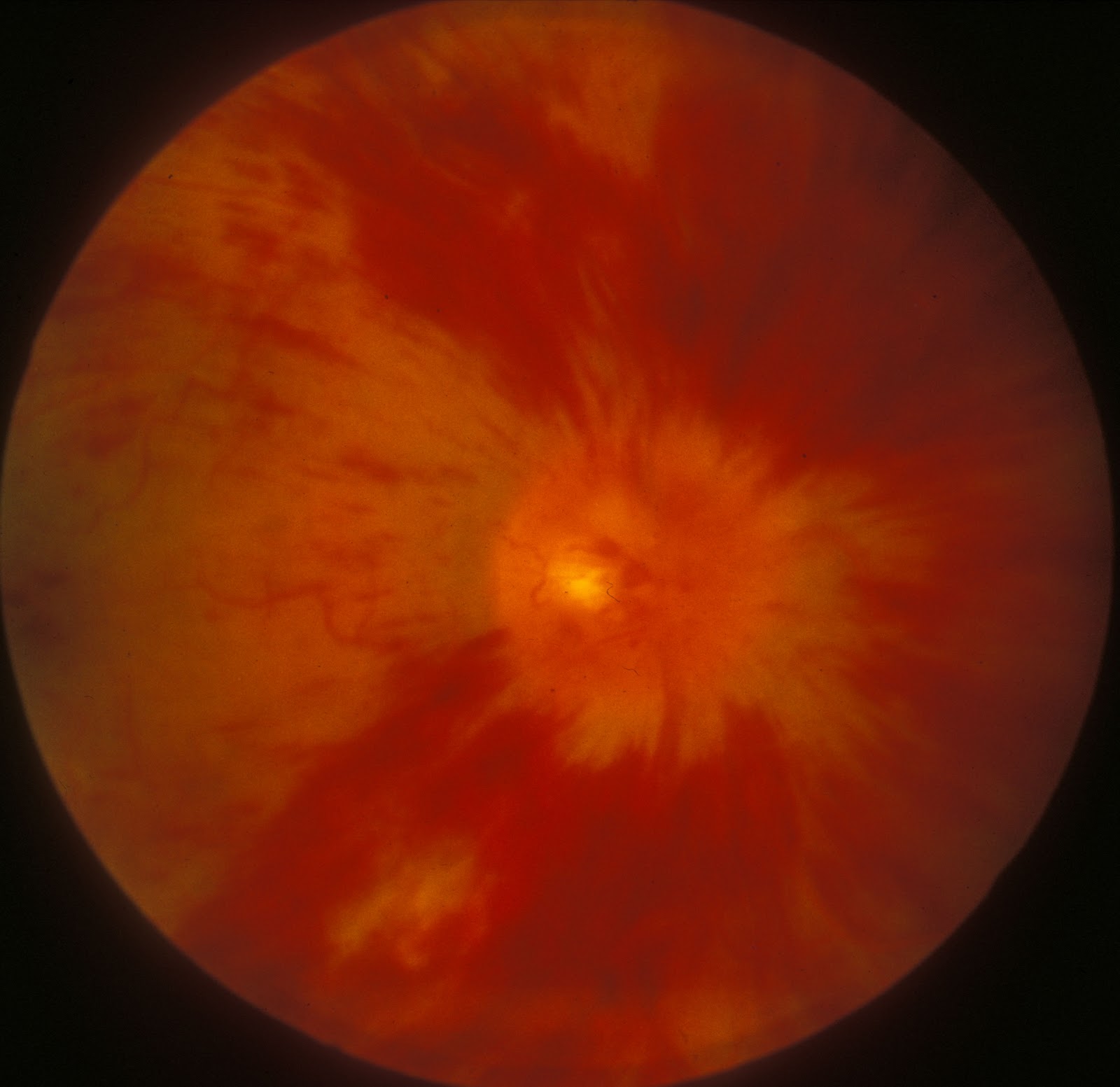 Dr. Iman: OSCE Ophthalmology