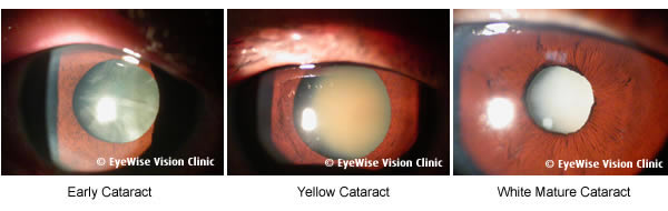 Dr. Iman: OSCE Ophthalmology