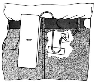 Angelite Nurses: Diabetes Mellitus