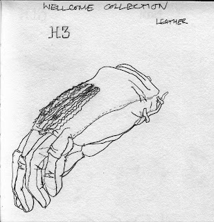 KILLUSTRATION: prosthetic hand