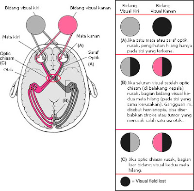 Gangguan Saraf Optik Mata - Terapi Sehat : Info Kesehatan Medis dan ...