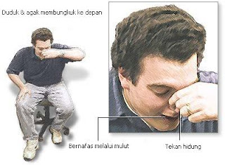 Perdarahan Hidung (Epistaksis, Mimisan) - Terapi Sehat : Info Kesehatan ...