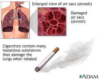 human cardiac and respiratory system: The relationship between smoking ...