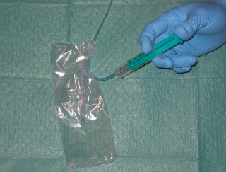 ENFERMESALUD: SONDAS NASOINTESTINALES