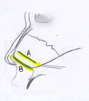 MCQ's in Facial Plastic & Reconstructive Surgery: 701-710 MCQ in Facial ...