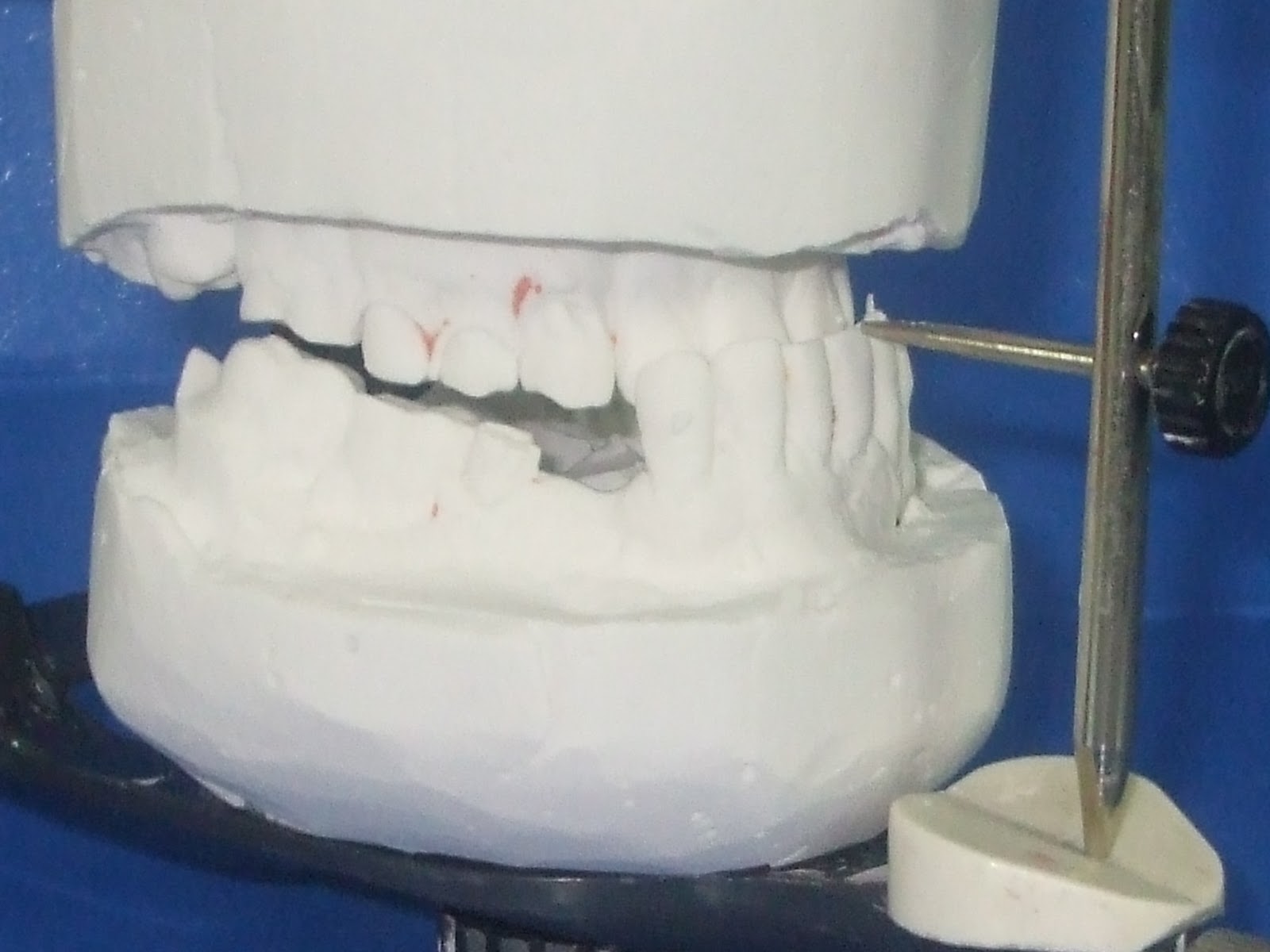 Laboratorio Ortodontico MRdental: Bite DTM III CL