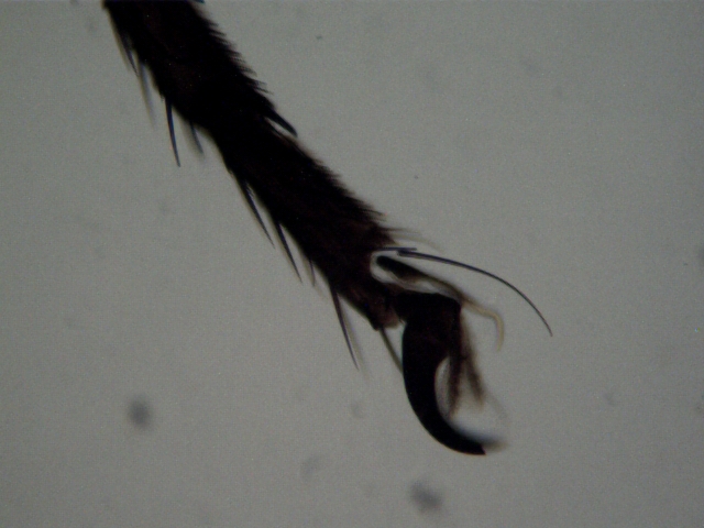 Microfotografias: Pata de una mosca.