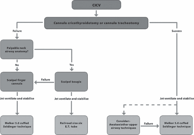 歲月麻醉: CICV 終極版氣道處理
