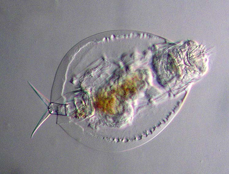 Beyond the Human Eye: Another Rotifer....