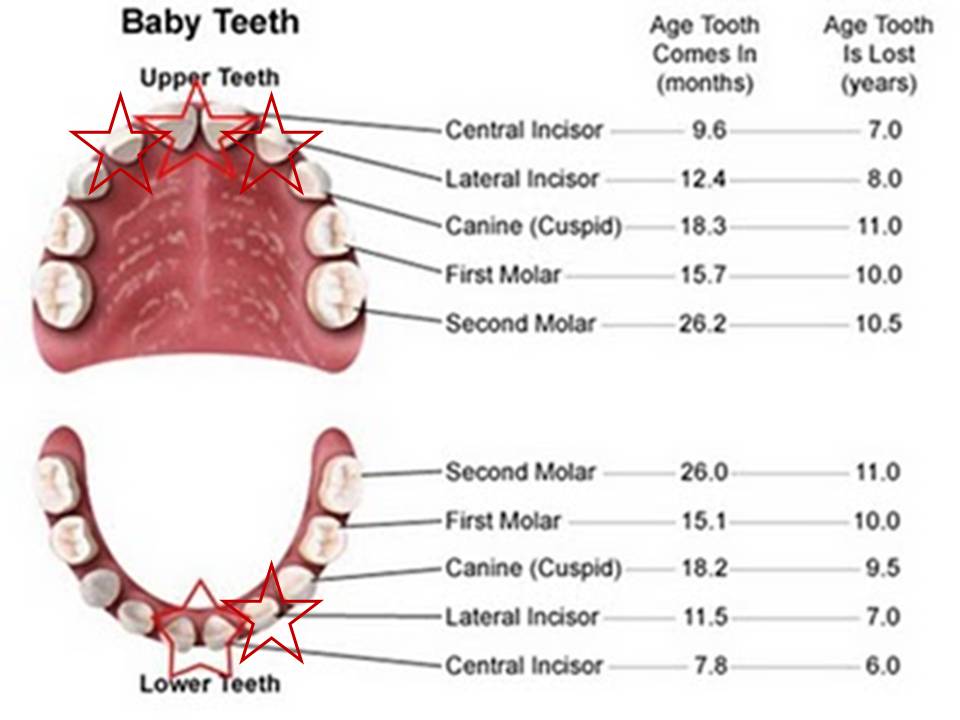♥♥♥ ThE TaNeS PeRfeCto FaMiLia♥♥♥: VISH VISH 5TH, 6TH & 7TH TOOTH: BOTH ...
