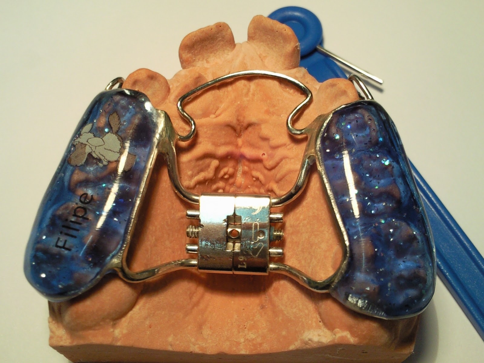 DentalLab: Aparelhos de Disjunção